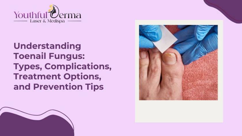 Toenail Fungus Types Complications Treatment Options and Prevention ...